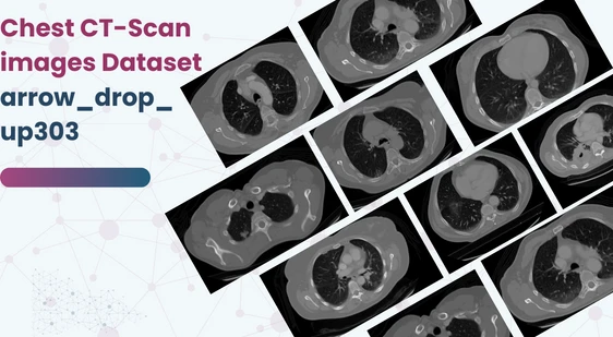 Chest CT-Scan images Dataset