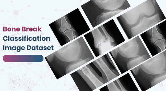 Bone Break Classification Image Dataset