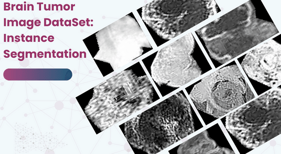 Brain Tumor Image Dataset Instance Segmentation 2632