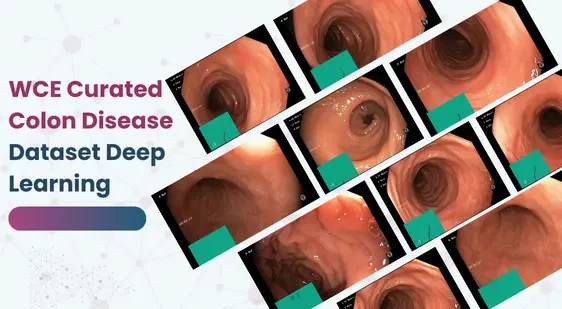 WCE Curated Colon Disease Dataset Deep Learning