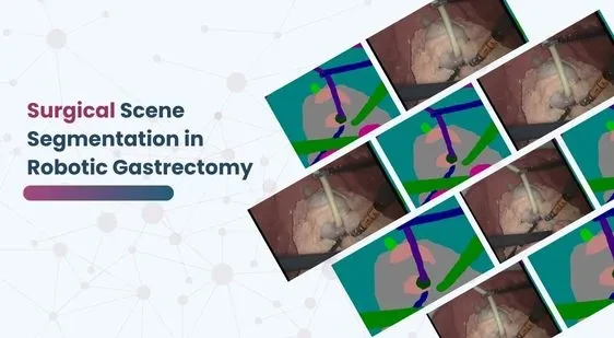 Surgical Scene Segmentation in Robotic Gastrectomy