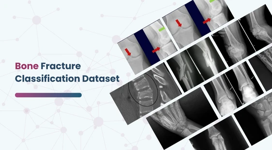 Bone Fracture Classification Dataset for Medical Research