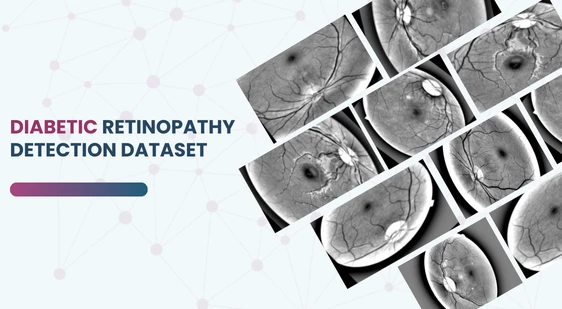 Diabetic Retinopathy Detection Dataset for Medical Imaging Diabetic Retinopathy Detection Dataset for Medical Imaging