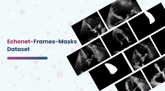 Echonet-Frames-Masks Dataset for Medical Image Segmentation