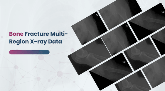 Multi-Region Bone Fracture X-ray Dataset
