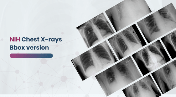 NIH Chest X-rays Bbox version | GTS