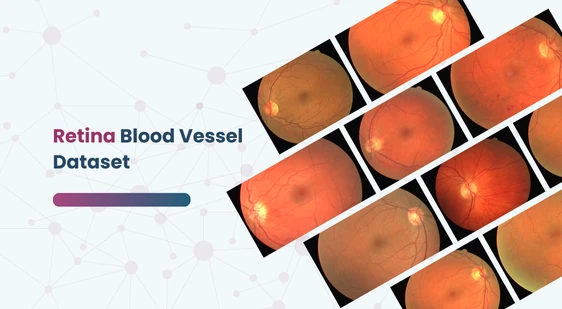 Retina Blood Vessel Dataset for Advanced Medical Image Analysis