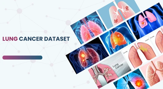 Lung Cancer Dataset for Early Detection | AI-driven Health Solution