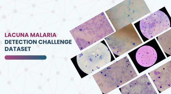 Blood Slide Image Dataset for Malaria Diagnosis | GTS