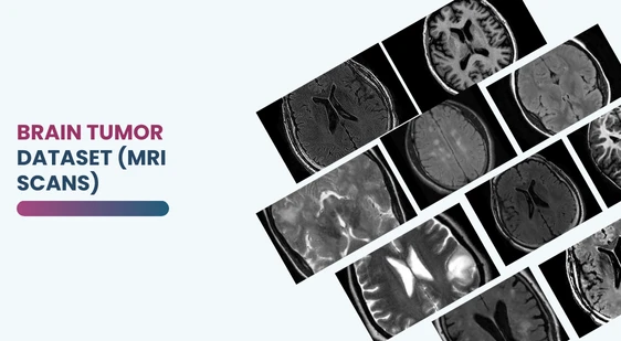 Brain Tumor Detection With Advanced Mri Dataset