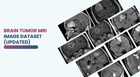 Brain Tumor MRI Dataset for AI and Medical Imaging Research