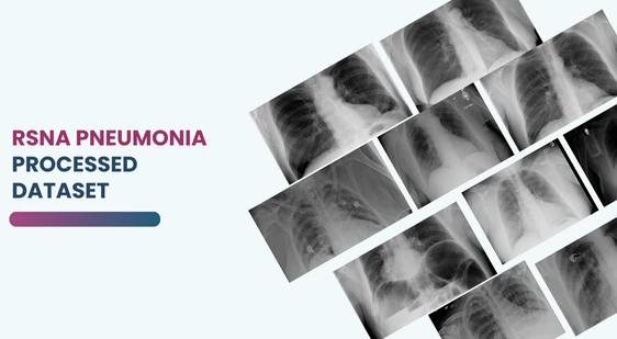 Rsna Pneumonia Detection Dataset Pre Processed Medical