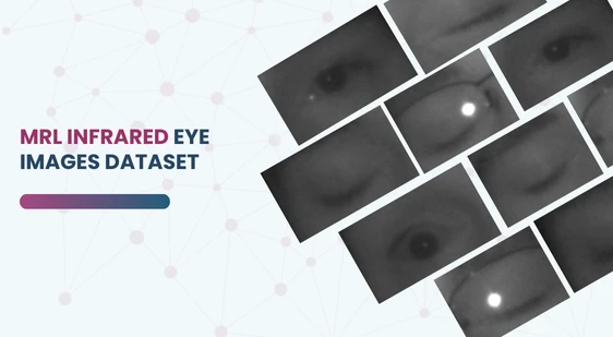MRL Eye Dataset: Advanced Drowsiness Detection Data